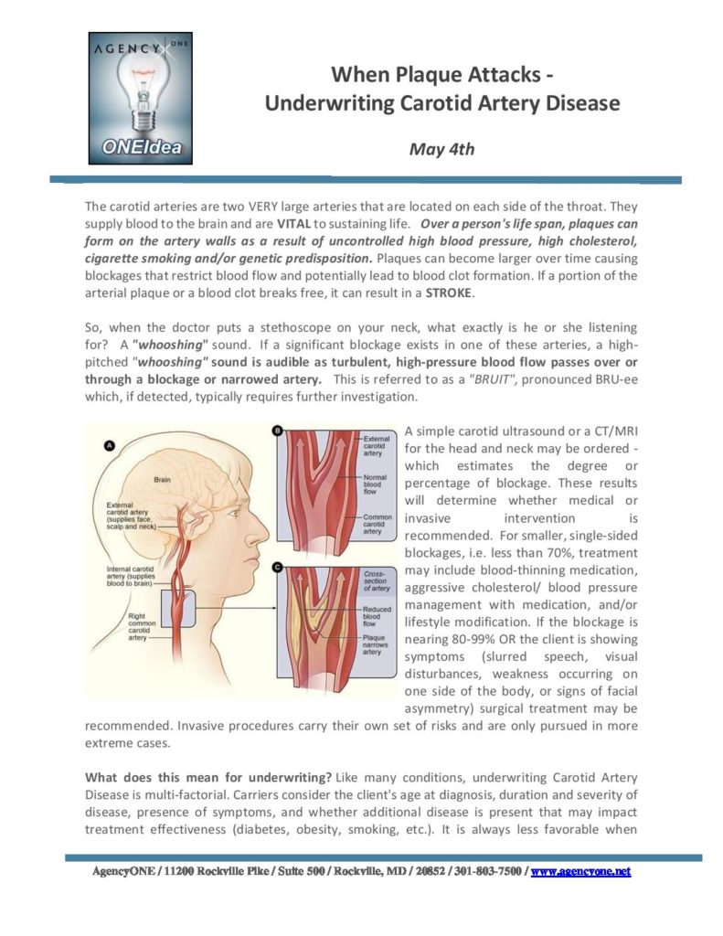 5.4.2018 When Plaque Attacks - Agency One